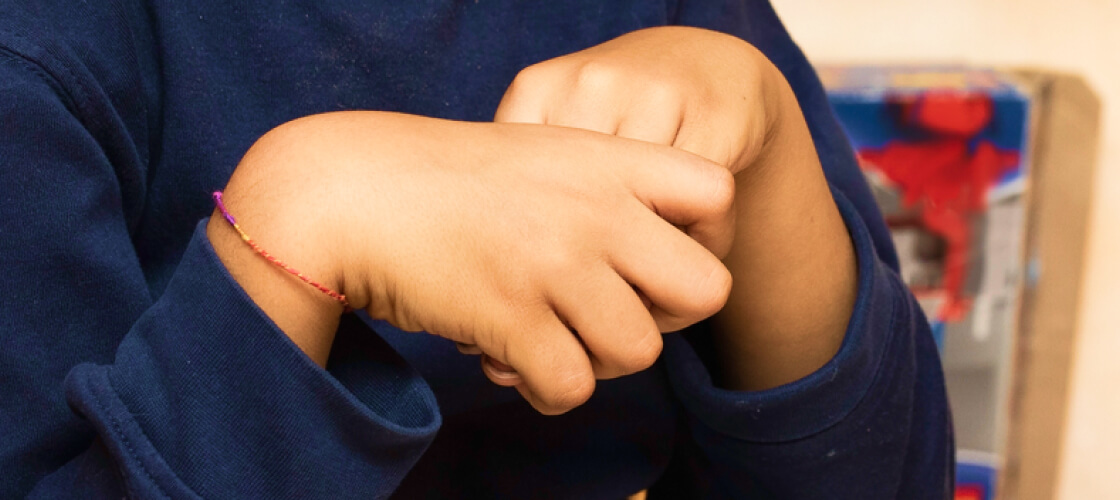 Alien Hand Syndrome: How Unwanted Movement Disrupts Lives - Docquity