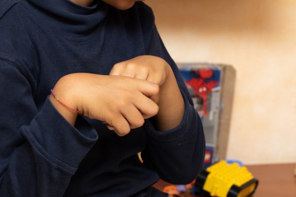 Alien Hand Syndrome: How Unwanted Movement Disrupts Lives - Docquity